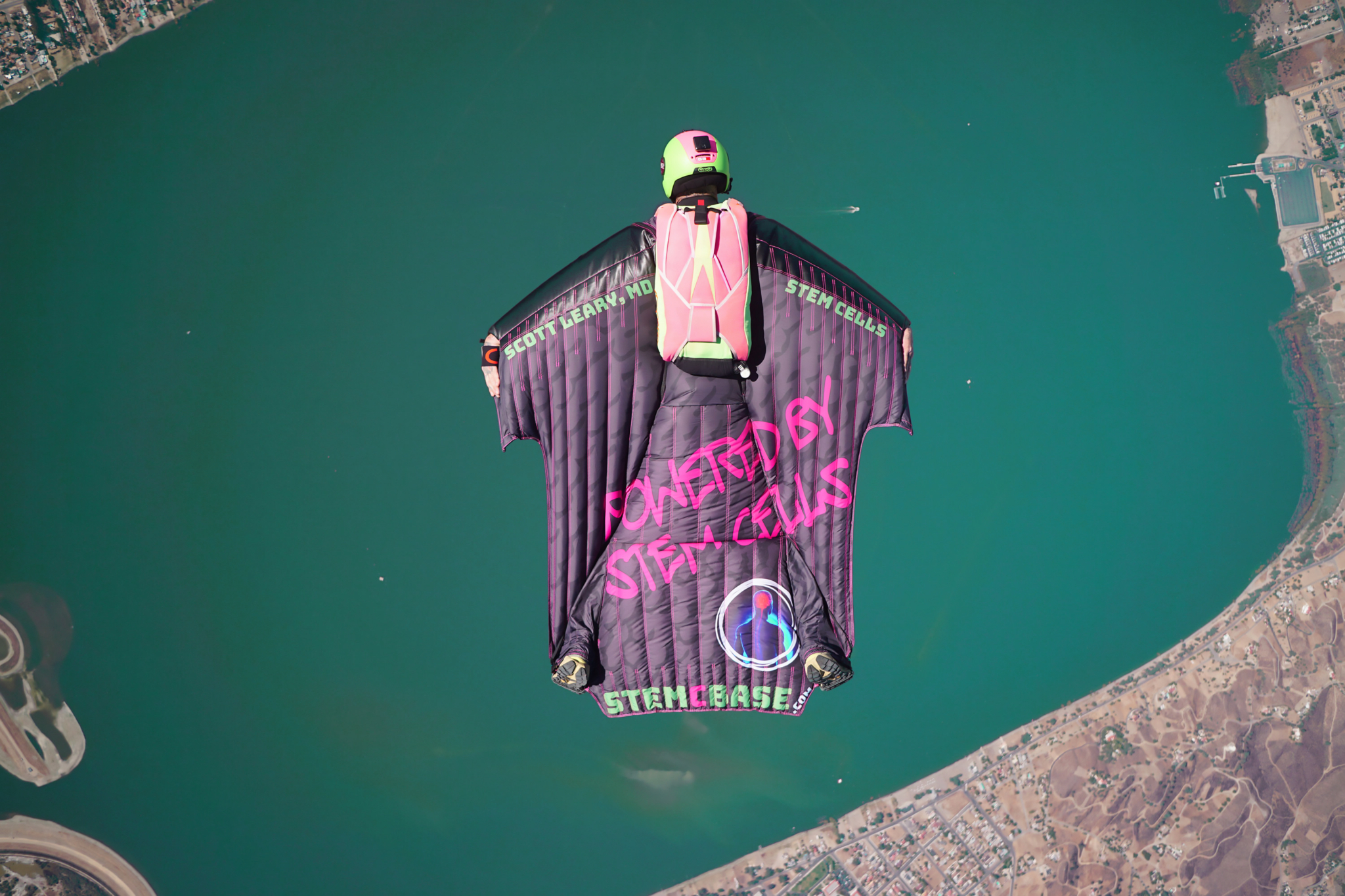 Regenerative Stem Cell Therapy - Scott Leary MD